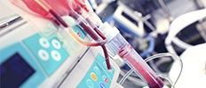 Autotransfusion Systems Market | Growing at a CAGR of 5.0% ...