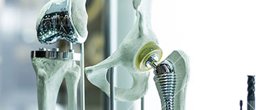 Orthopedic Implants Market Report 2024-2029, By Product, Material, and Geo