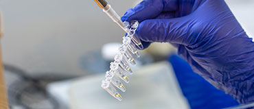 NGS Sample Preparation Market Trends & Growth Drivers | MarketsandMarkets