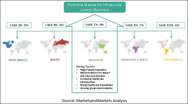 Intraocular Lens Market by Type & Material. Global Forecast to 2022 ...