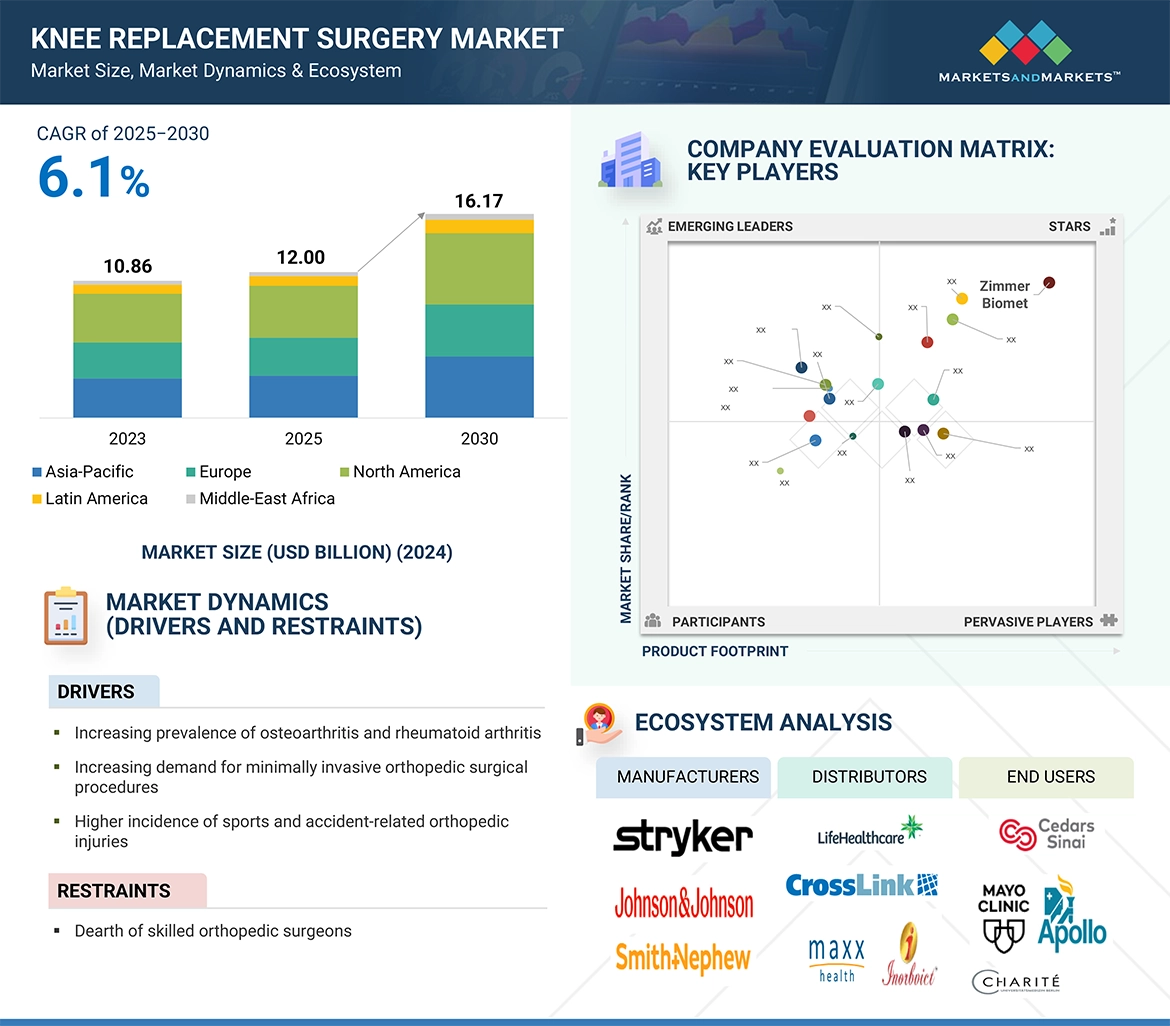Knee Replacement Surgery Market Size & Growth Forecast to 2030